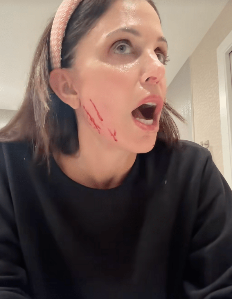 Bethenny Frankel Cuts Her Face Open With Skincare Product