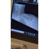 Jelly Roll Reveals the 'Secret' Injury He Hid During the 2026 Grammys ...