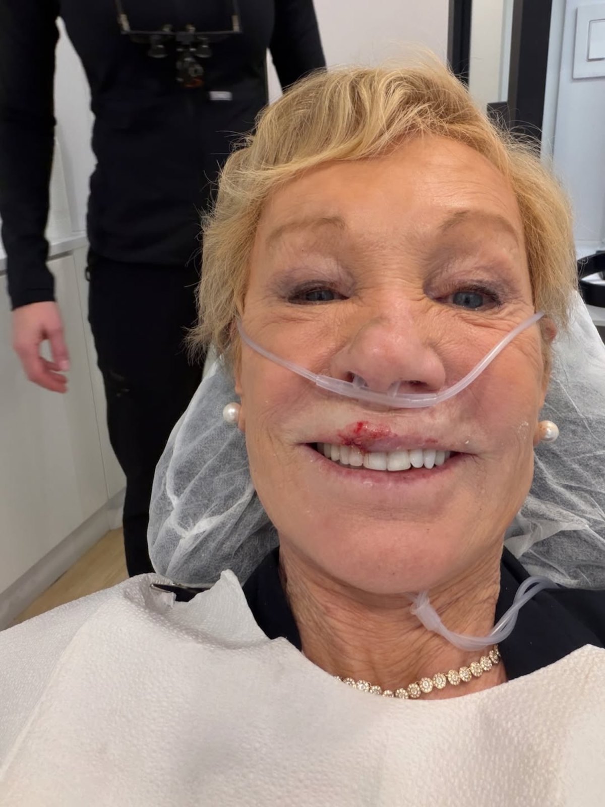 Barbara Corcoran Shows Aftermath of Broken Tooth, Split Lip | Us Weekly