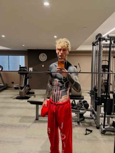 MGK's Skin Turned 'Yellow' After Rushing Blackout Tattoo