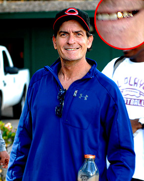 Whoa! See Charlie Sheen's Mouthful of Gold Teeth - Us Weekly
