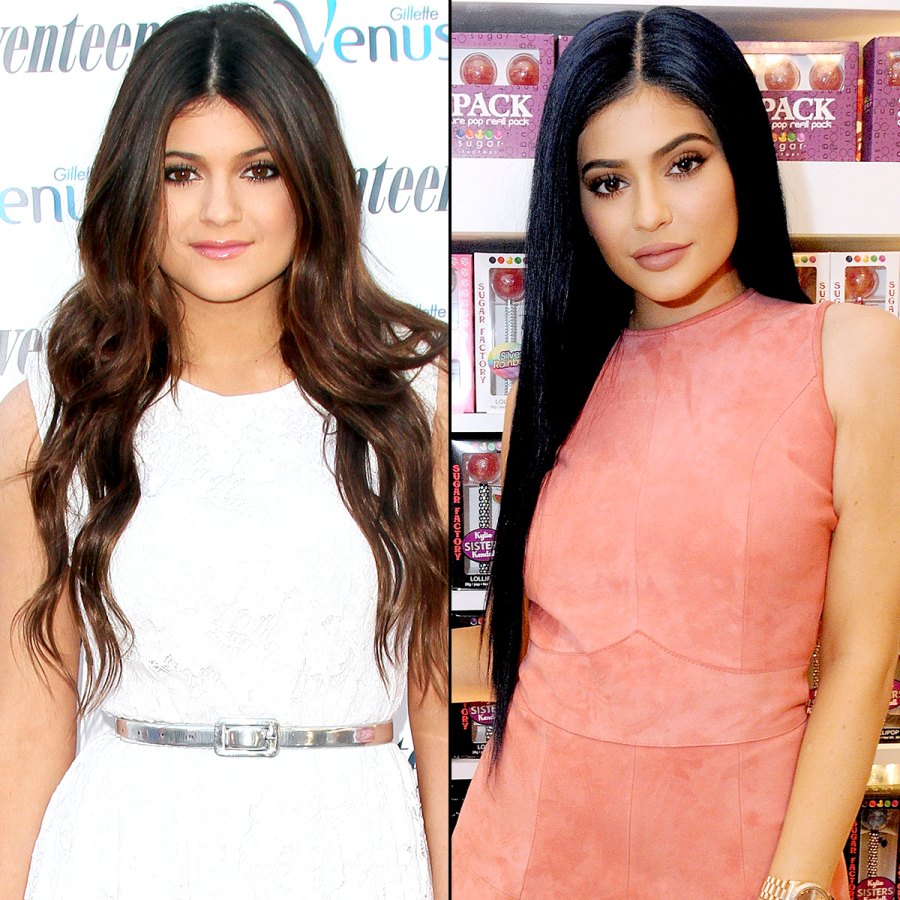 See How Kylie’s Face Has Changed in This 30-Second Video!