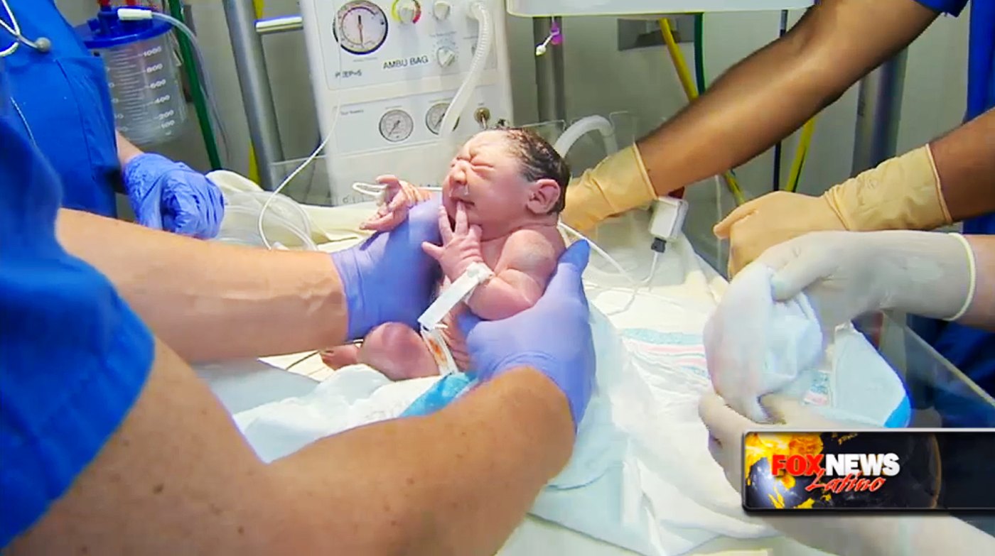 Mom of Baby Born With Zika-Related Microcephaly Speaks Out